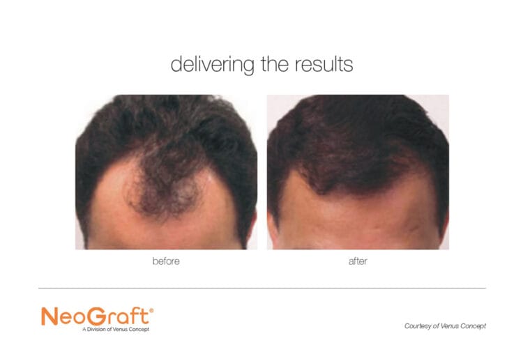 Testimonials The Men's Clinic Jakarta — Real Stories Real Results