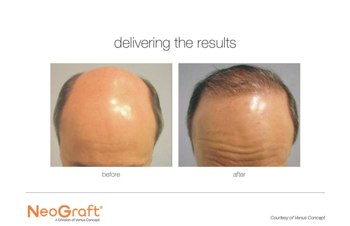 Testimonials The Men's Clinic Jakarta — Real Stories Real Results