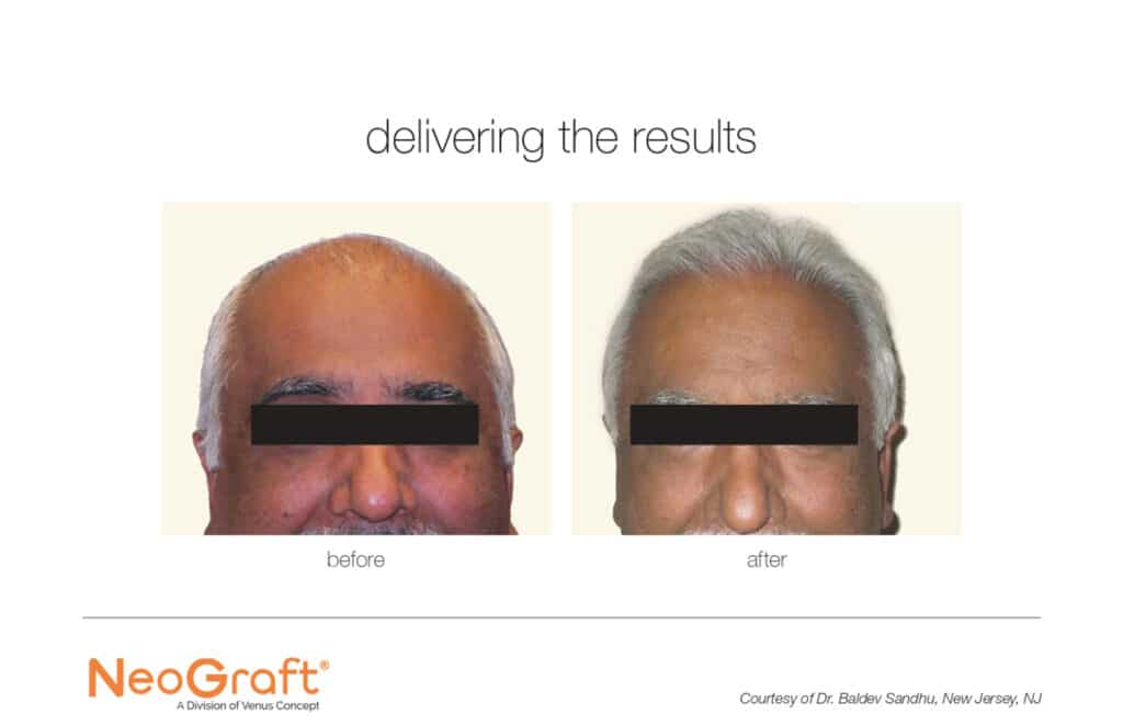 Testimonials The Men's Clinic Jakarta — Real Stories Real Results