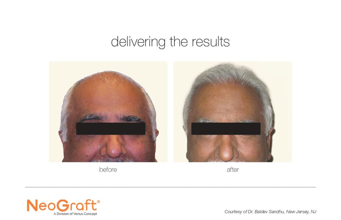 Testimonials The Men's Clinic Jakarta — Real Stories Real Results