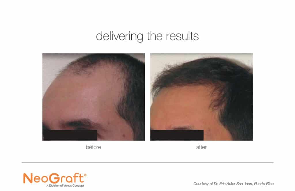 Testimonials The Men's Clinic Jakarta — Real Stories Real Results